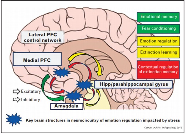 Panic Attack Brain Scan